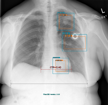 CXR-AI Plus.CXR – PlusmanLLC
