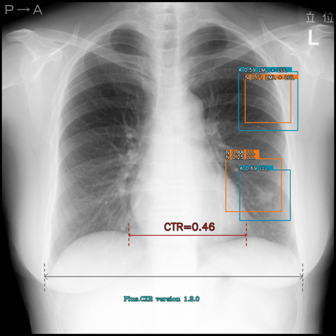 CXR-AI Plus.CXR – PlusmanLLC