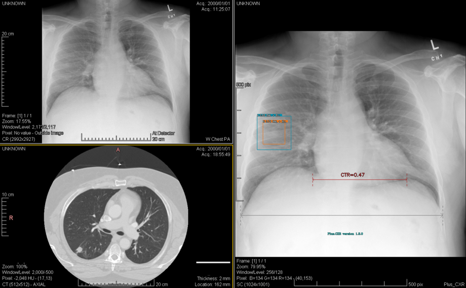 CXR-AI Plus.CXR – PlusmanLLC
