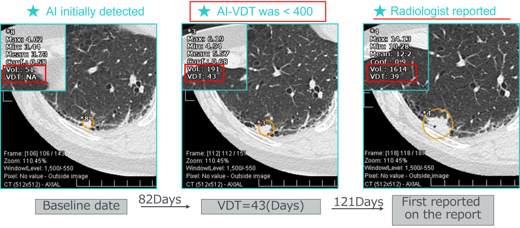 Plus.Lung.Nodule – PlusmanLLC