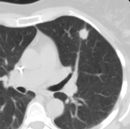 CXR-AI Plus.CXR – PlusmanLLC