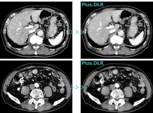 Plus.DLR – PlusmanLLC